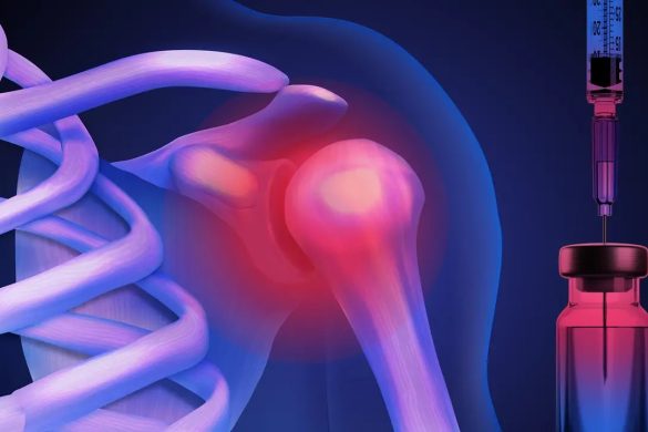 ΣΠΟΝΔΥΛΟΒΑΣΙΚΗ ΑΝΕΠΑΡΚΕΙΑ ΚΑΙ ΑΥΧΕΝΙΚΗ ΣΠΟΝΔΥΛΩΣΗ - Megamed.gr