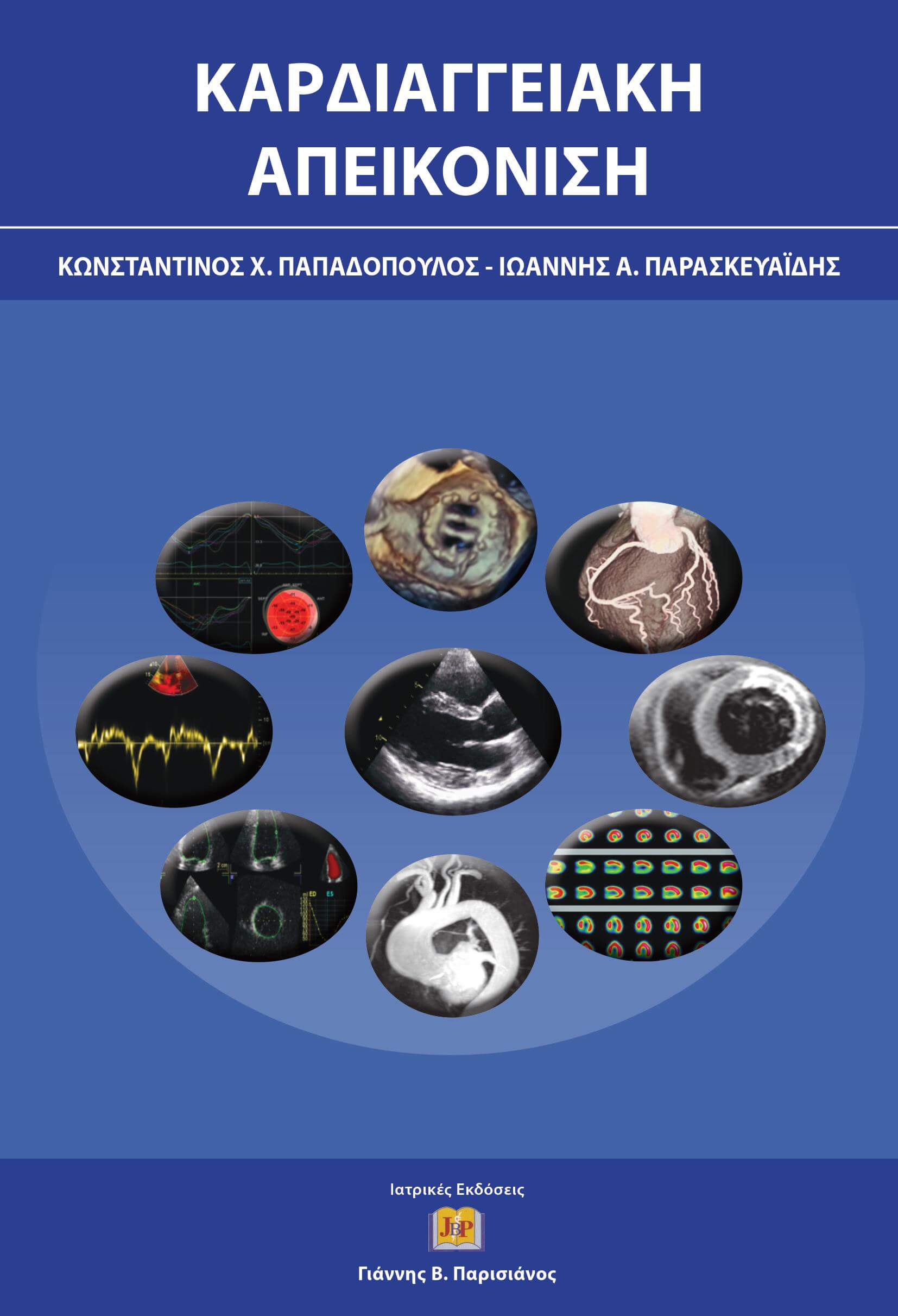 ΚΑΡΔΙΑΚΗ ΑΠΕΙΚΟΝΙΣΗ, K. Παπαδόπουλος, Ι. Παρασκευαΐδης - Megamed.gr