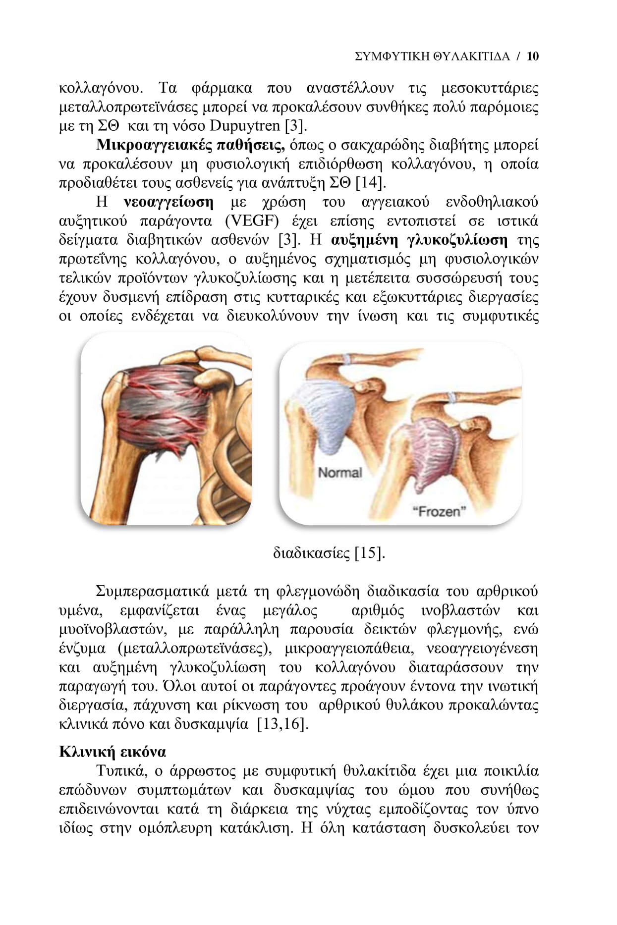 Συμφυτική θυλακίτιδα | Ψυχρός ή Παγωμένος Ώμος - Megamed.gr