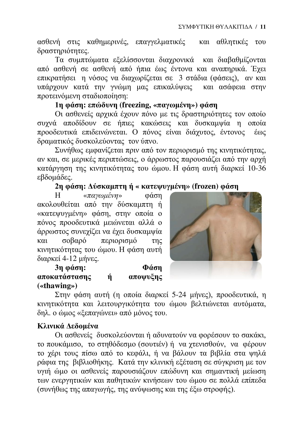 Συμφυτική θυλακίτιδα | Ψυχρός ή Παγωμένος Ώμος - Megamed.gr