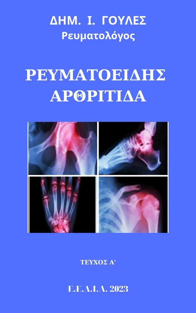 ΘΕΡΑΠΕΙΑ ΡΕΥΜΑΤΟΕΙΔΟΥΣ ΑΡΘΡΙΤΙΔΑΣ - Megamed.gr